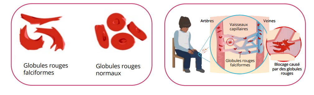 Soins et services offerts au CHU Sainte-Justine - A