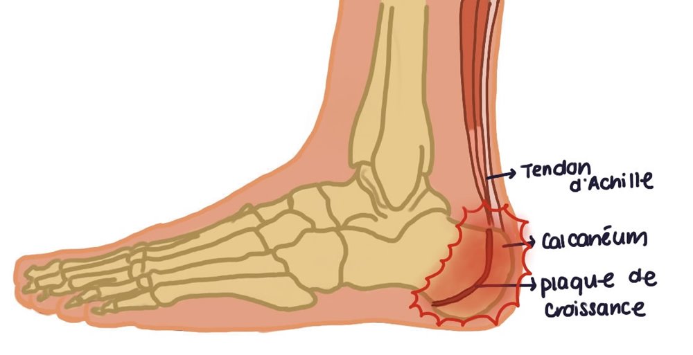 Médecine sportive (clinique de médecine du sport)